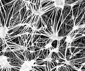 GORE® FireWire® Cables for Civil Aircraft | Gore